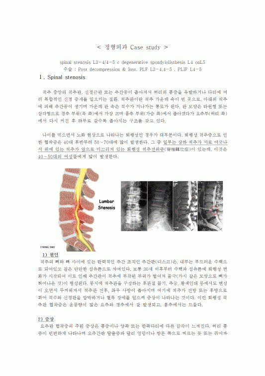 spinal stenosis 정형외과 case study