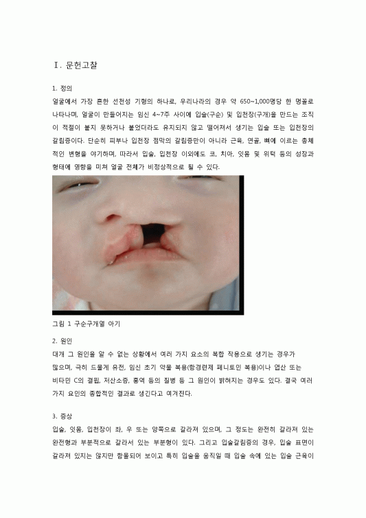 [아동 케이스] cleft palate 구개열 케이스