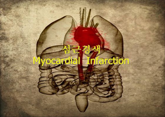 해부생리학 - 심근경색[Myocardial  Infarction]에 대해