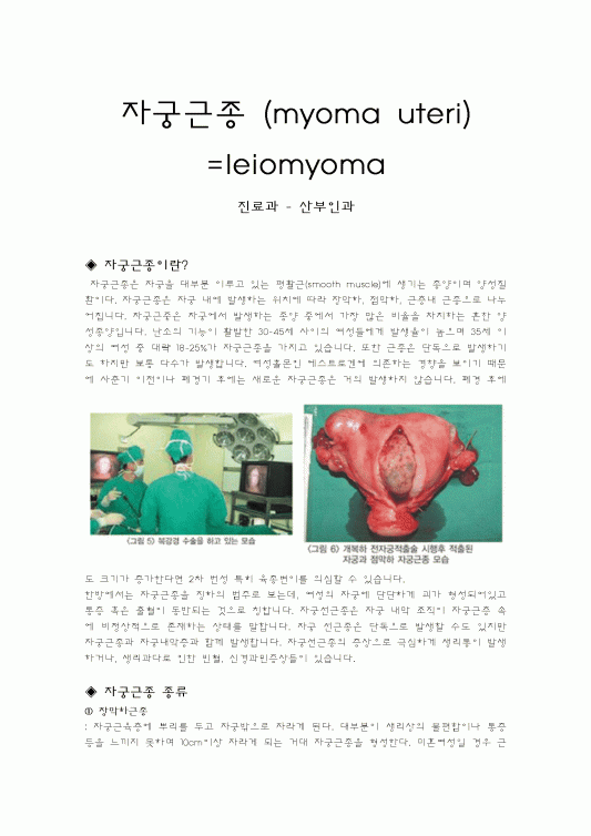 [모성학] 자궁근종 (myoma uteri=leiomyoma)