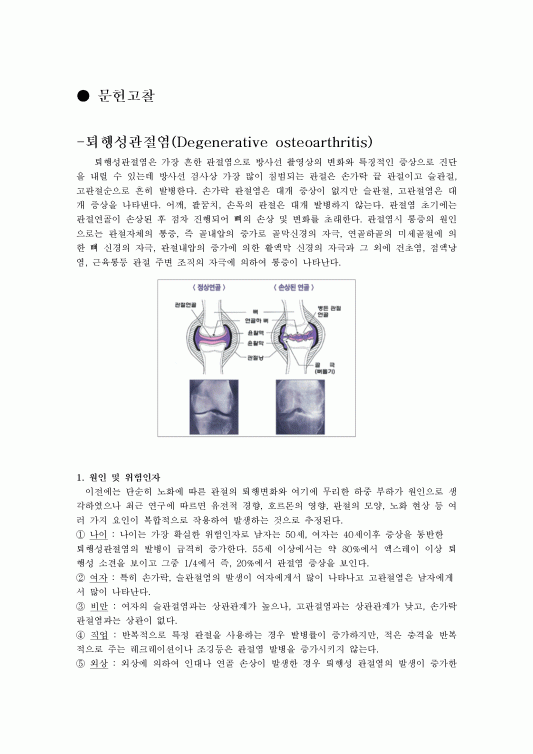 문헌고찰-퇴행성관절염, TKR