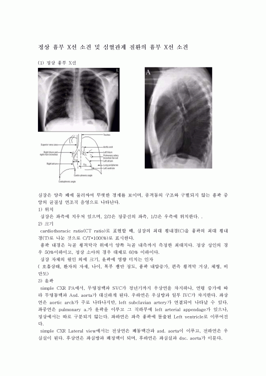 [의대 본과 pk 실습] 정상 흉부 X선 소견 및 심혈관계 질환의 흉부