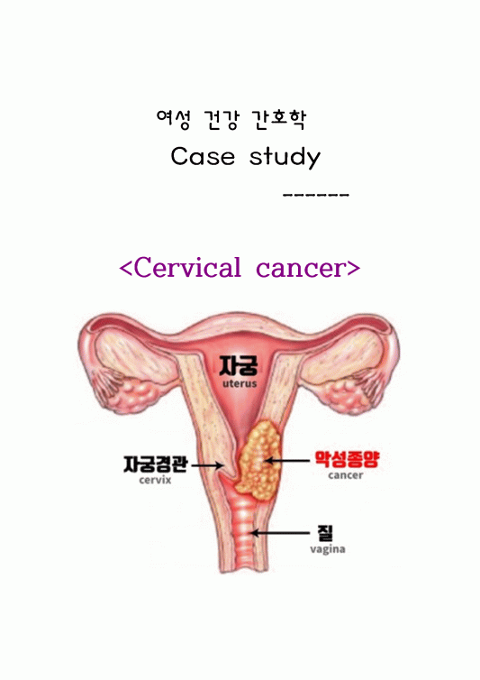 여성건강간호학 자궁경부암 case study 간호진단 2개, 간호과정1개, 문헌고찰 포함 A+ 받았습니다!!