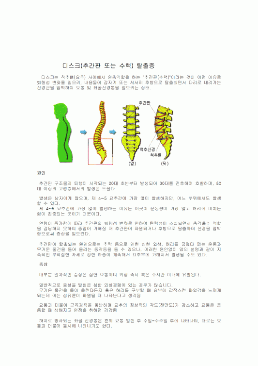 추간판 탈출증(HNP)