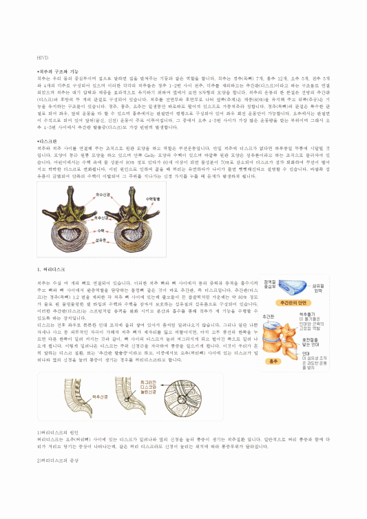 디스크-추간판 탈출증