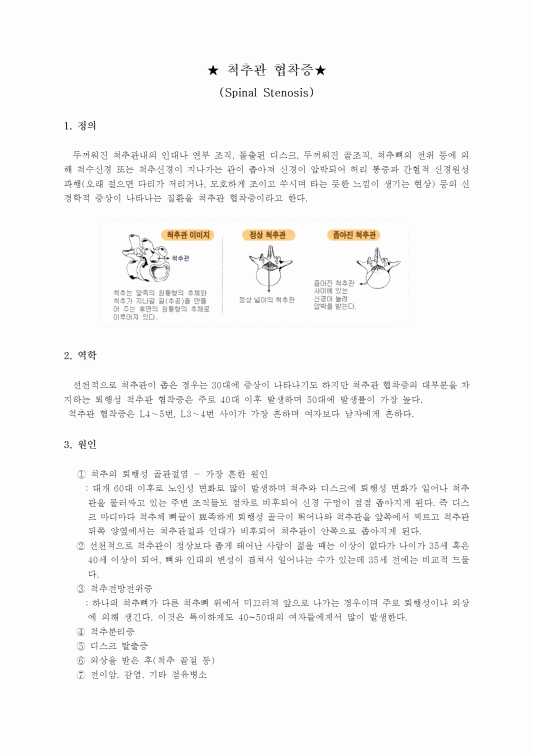 척추관 협착증