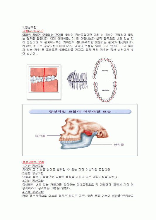 정상교합과 부정교합