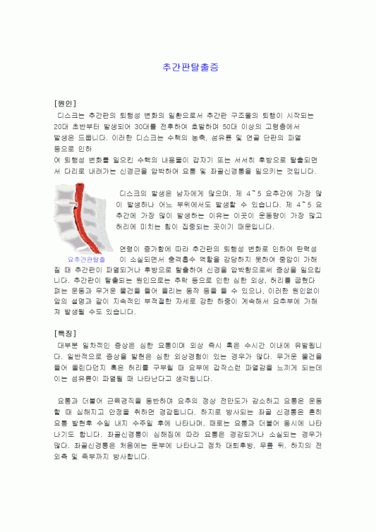 추간판탈출증