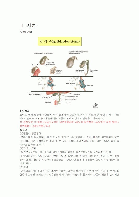 담석증,총담관석증(GB,CBD stone)