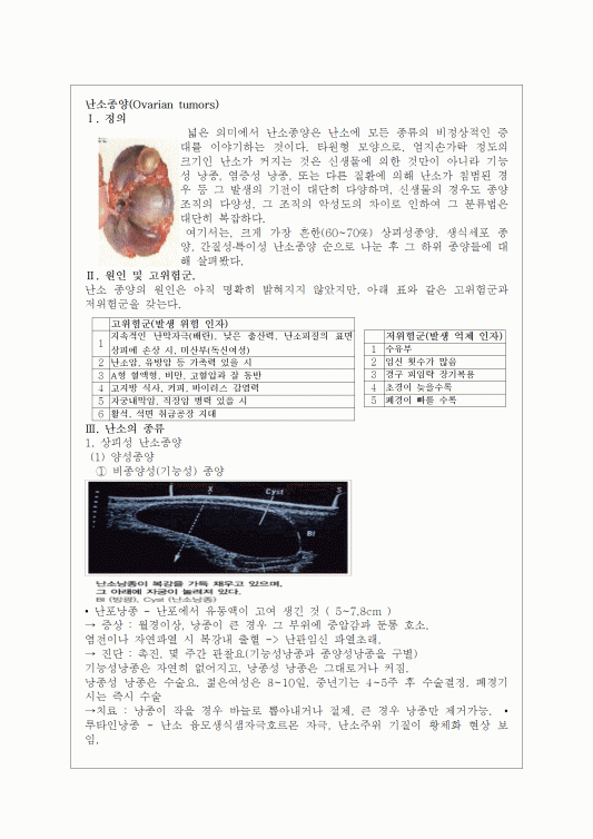 난소종양(Ovarian tumors)