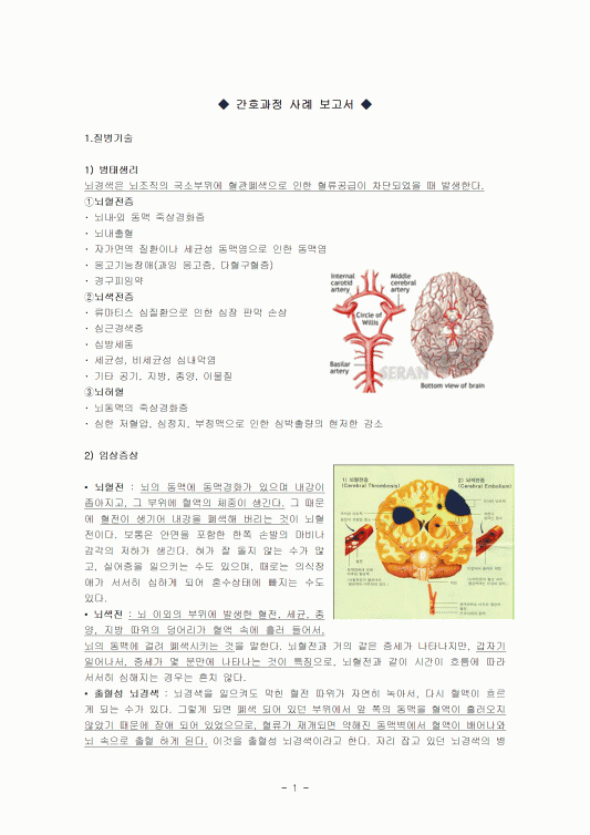 뇌경색 간호과정 사례 보고서