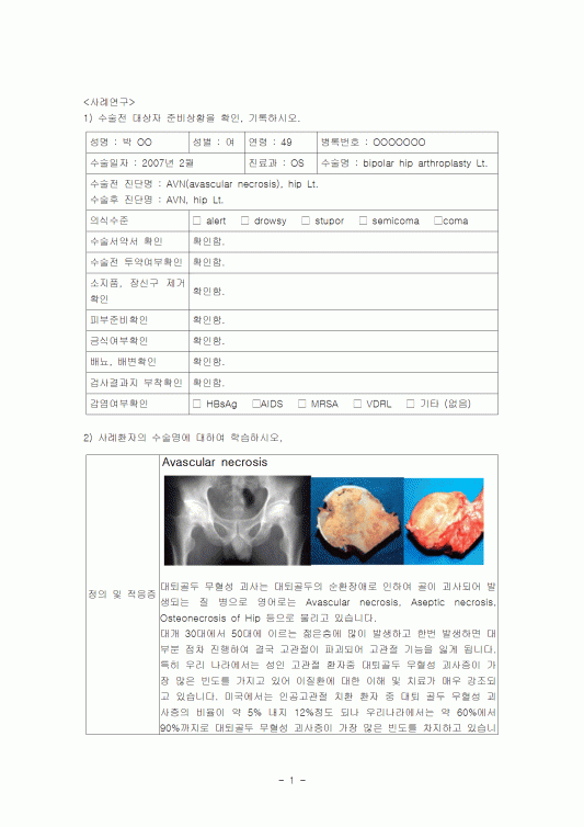 인공고관절 치환술 사례연구