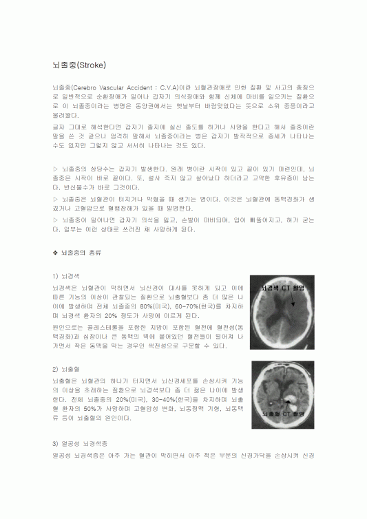 뇌졸중 문헌고찰 뇌경색