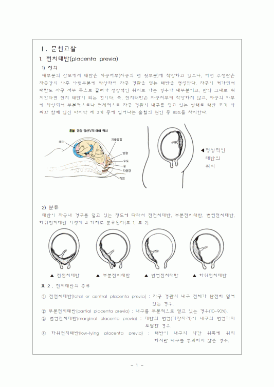 전치태반으로 인한 제왕절개수술