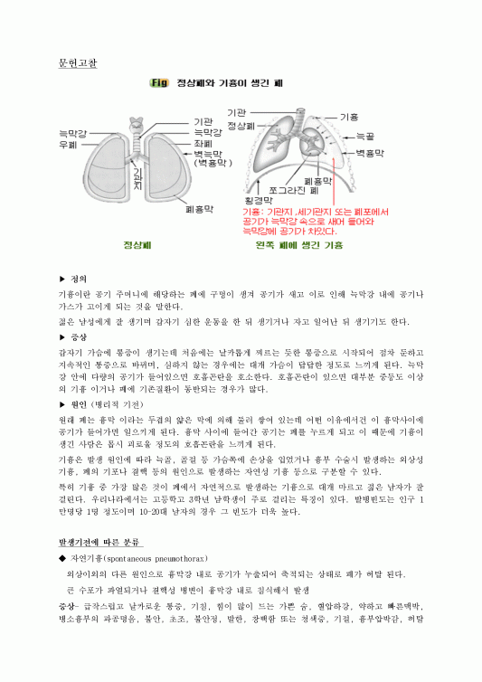 기흉 case