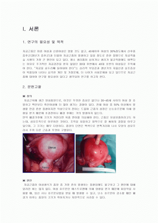 수술실-TAH.자궁근종 case study