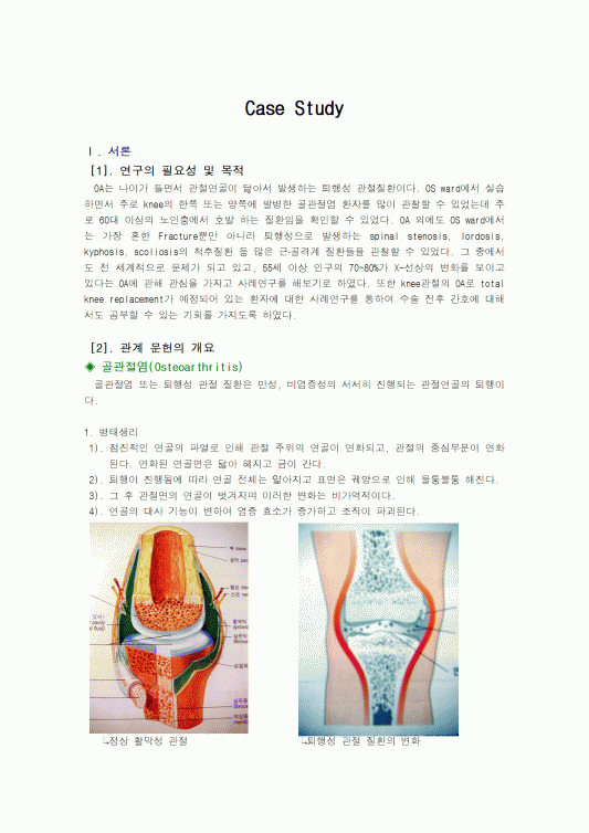 골관절염(Osteoarthritis) 케이스