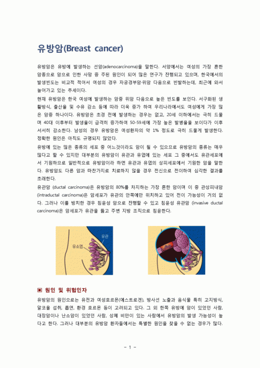 유방암(Breast cancer)