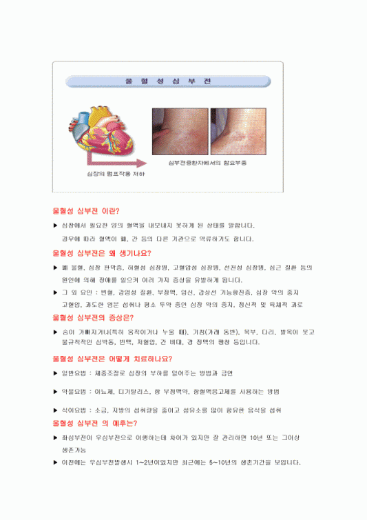 첨부파일 :  울혈성심부전.hwp