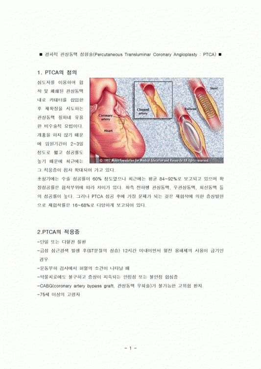 경피적 관상동맥 성형술(Percutaneous Transluminar Coronary Angioplasty : PTCA)