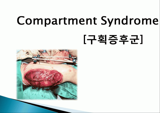 (성인) 구획증후군 Compartment Syndrome 사례연구