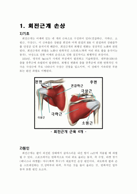 회전근개파열-case study