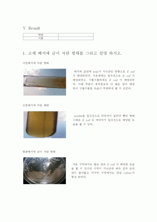 [미생물실험]1.배지제조 및 미생물 접종배양 2.미생물의 크기측정