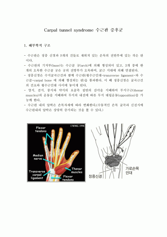 CTS : Carpal tunnel syndrome 수근관 증후군