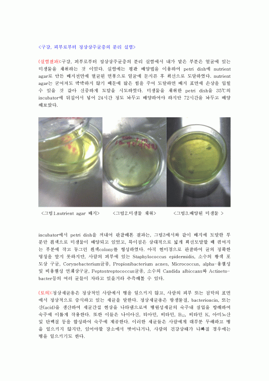 [미생물학실험] 구강, 피부로부터 정상상주균층의 분리 및 사면배양 실험