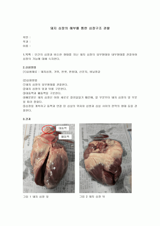 (결과) 돼지 심장의 해부를 통한 심장구조 관찰 - 인간의 심장과 비슷한 형태를 지닌 돼지 심장의 외부형태와 내부형태를 관찰하여 심장의 기능에 대해 숙지