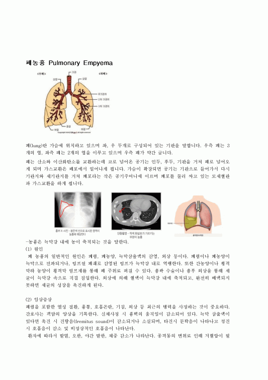 폐농흉 (Pulmonary Empyema) 케이스 스터디