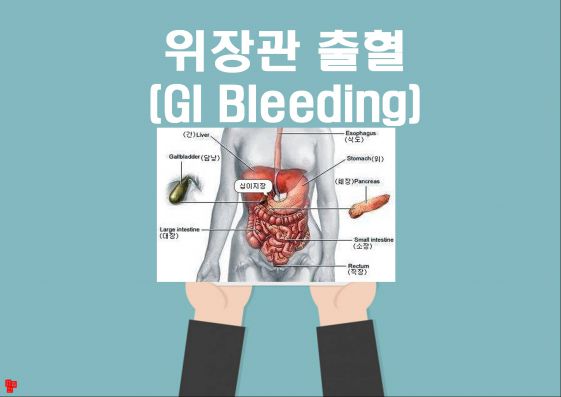 위장관 출혈 GI Bleeding 문헌고찰 정의 병태생리 증상 치료 간호과정 3개