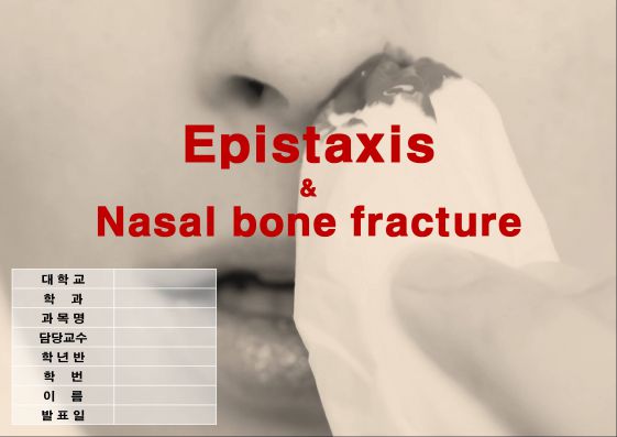 응급간호학 코피 epistaxis 비골 골절 nasal bone fracture 발표 자료