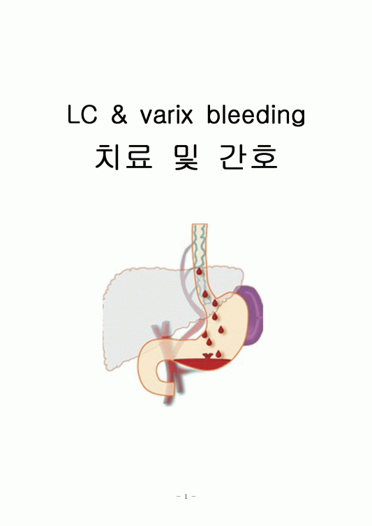 LC & varix bleeding 치료 및 간호