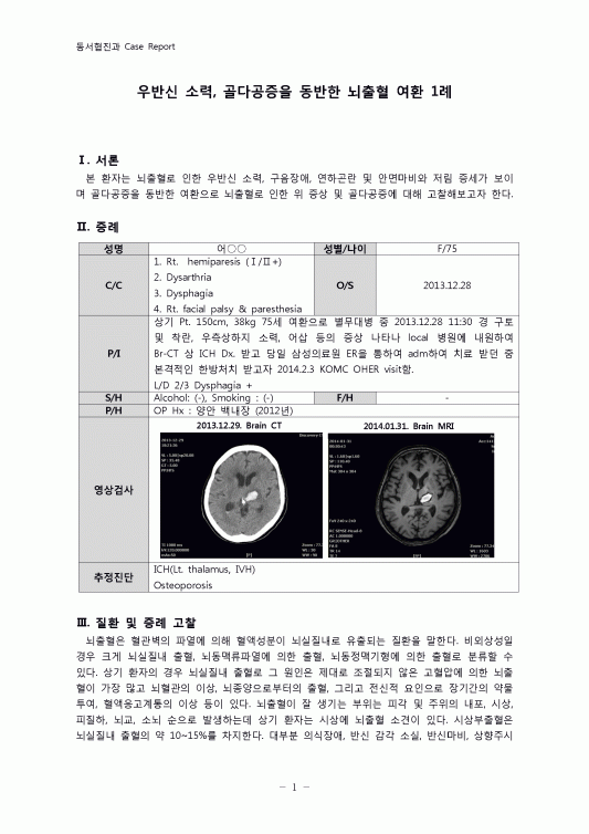 [동서협진과 CASE] 우반신 소력 골다공증을 동반한 뇌출혈 여환 1례