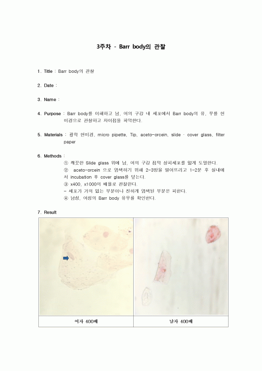 [일반생물학 실험] 바소체(barr body) 실험 결과레포트