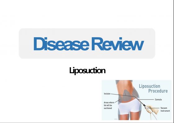 Liposuction(지방흡인술) 성형외과 NEJM 저널리뷰 7장 포함 일부대본