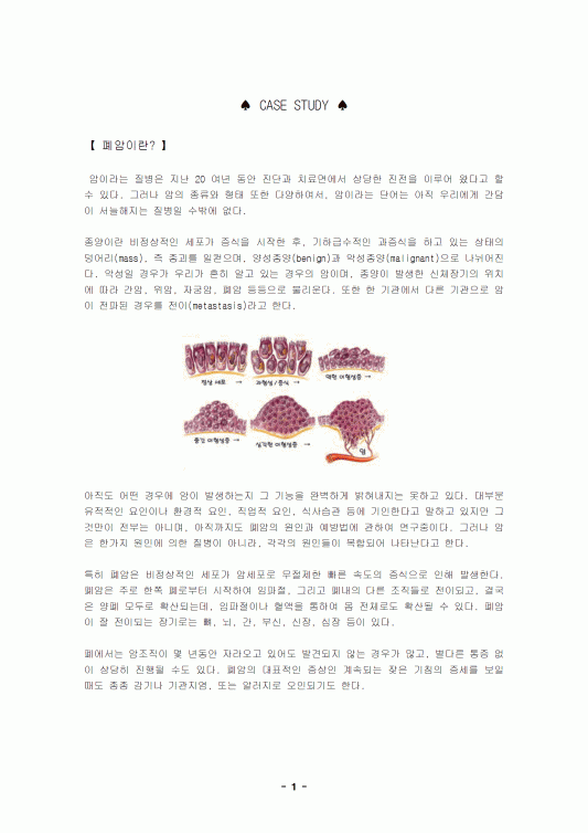 폐암이란 무엇인가?