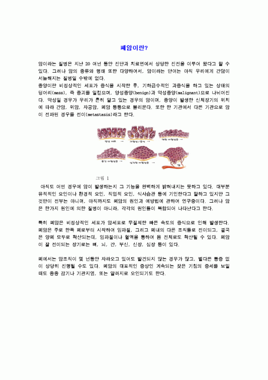 폐암과 흡연(다양한그림자료포함)