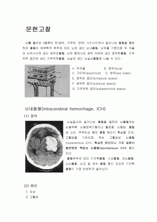 ICH(두개내 출혈)