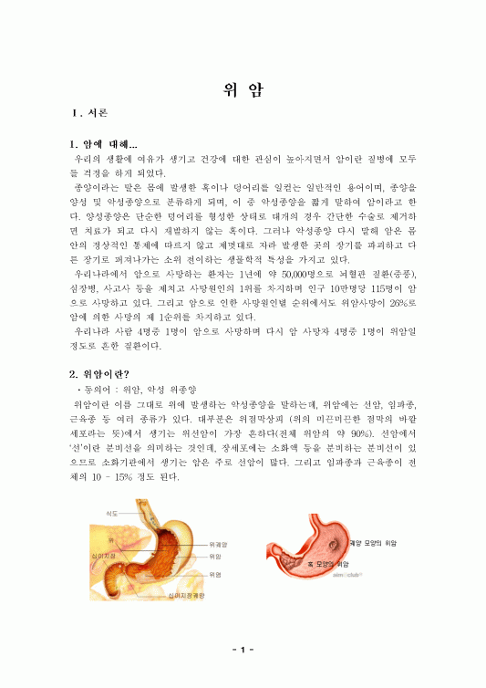 [논문] 위암(stomach cancer)