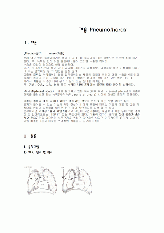 Case study - 기흉에 대한 Case study [CS]