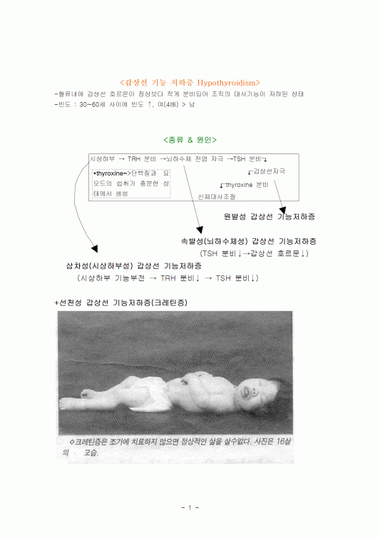 갑상선 기능저하증