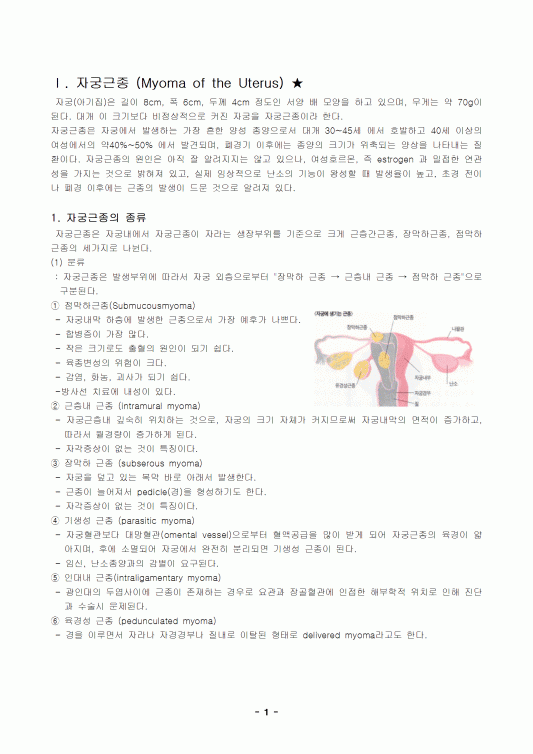 자궁근종 (Uterus myoma)