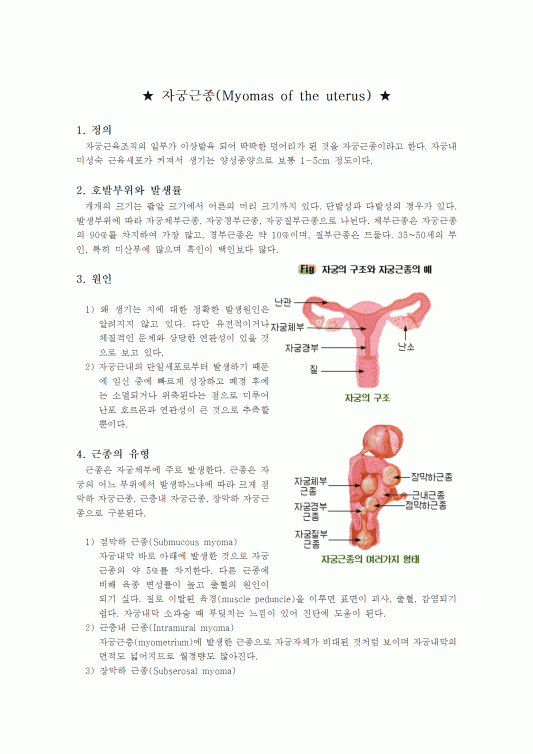 자궁근종 myoma uterine myoma 부인과