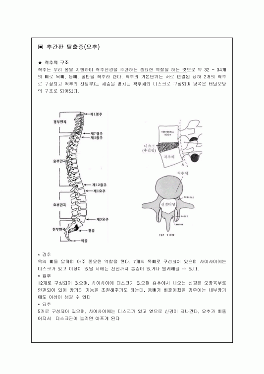 추간판탈출증 문헌고찰 및 case