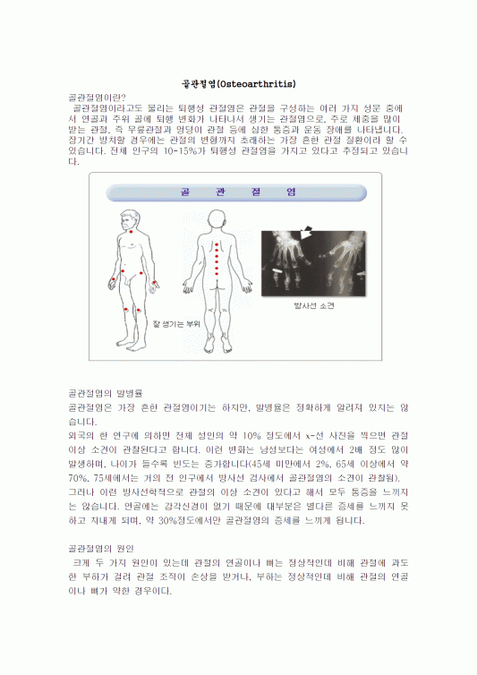 골관절염 간호진단 사례