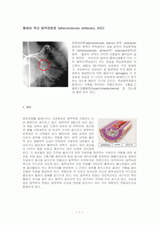죽상 동맥경화