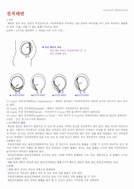 전치태반과 태반조기박리