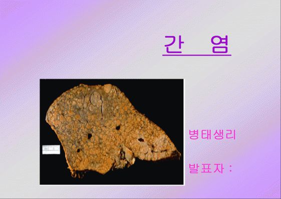 간염( 병태생리 ) 발표